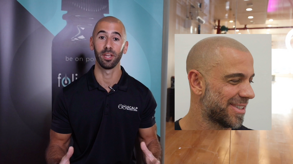 Matching Hair Color with Folicule Scalp Micropigmentation Ink